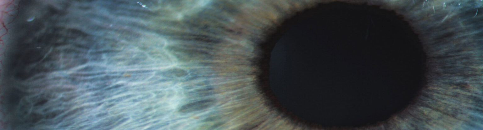 7 Causes of Low Vision are you at Risk - Clarity Laser Vision